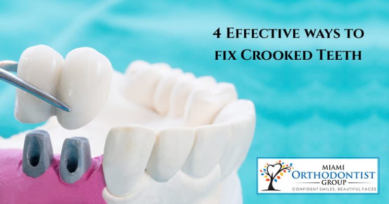 4 Effective Ways To Fix Crooked Teeth Miami Orthodontist Group Blog