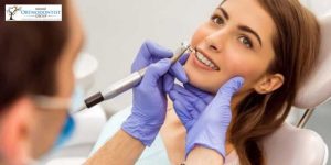 Bite Alignment and Its Impact on Facial Aesthetics