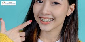 Bite Alignment and Its Impact on Facial Aesthetics