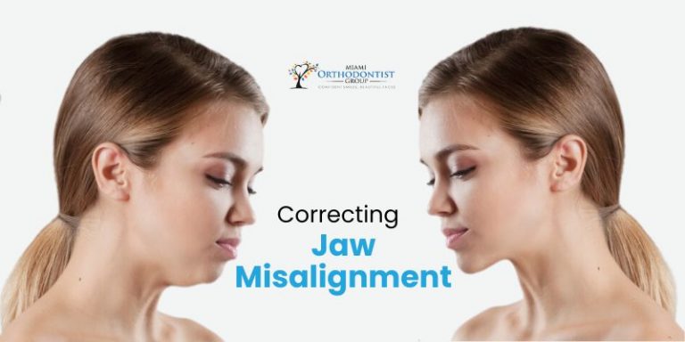 Correcting Jaw Misalignment: A Comprehensive Guide to Orthognathic Surgery