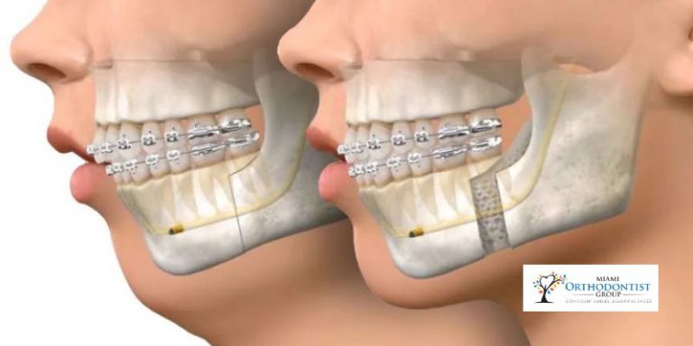 The Essential Guide to Orthognathic Surgery: Restoring Balance and Function